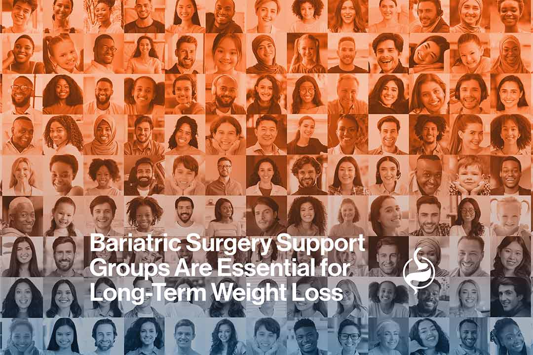 Bariatric Surgery Support Groups Are Essential for Long-Term Weight ...